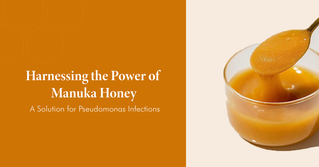 Utilizing Manuka Honey to Combat Pseudomonas Infections
